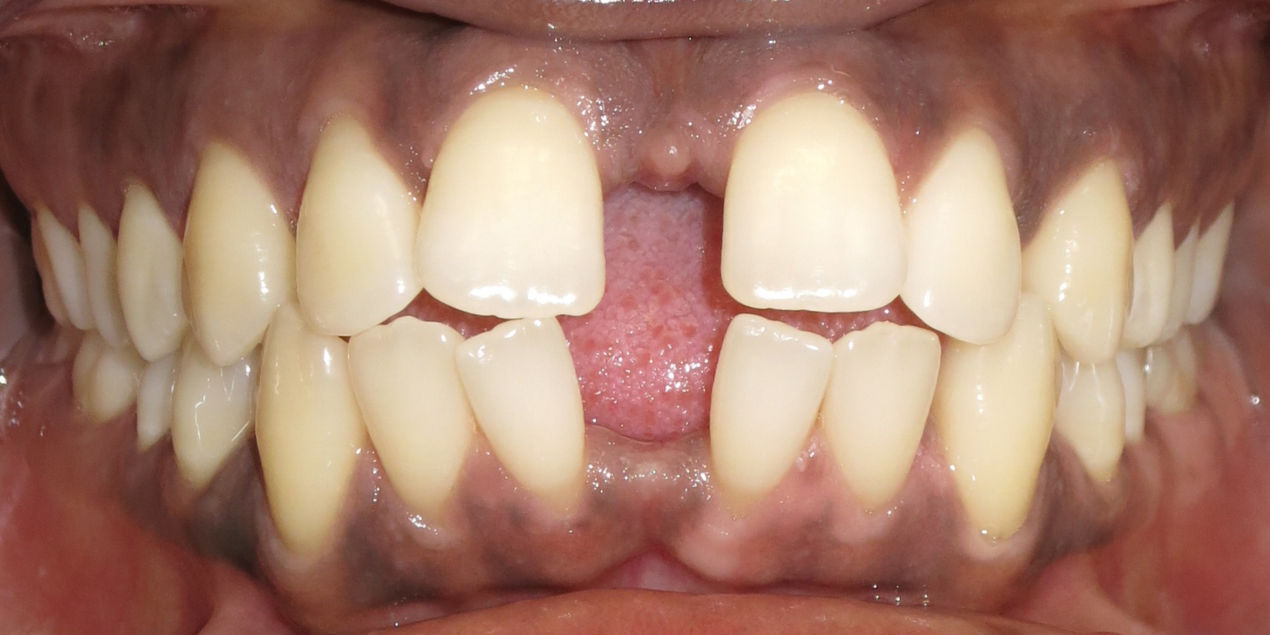 Shirley Orthodontics | Shirley, NY