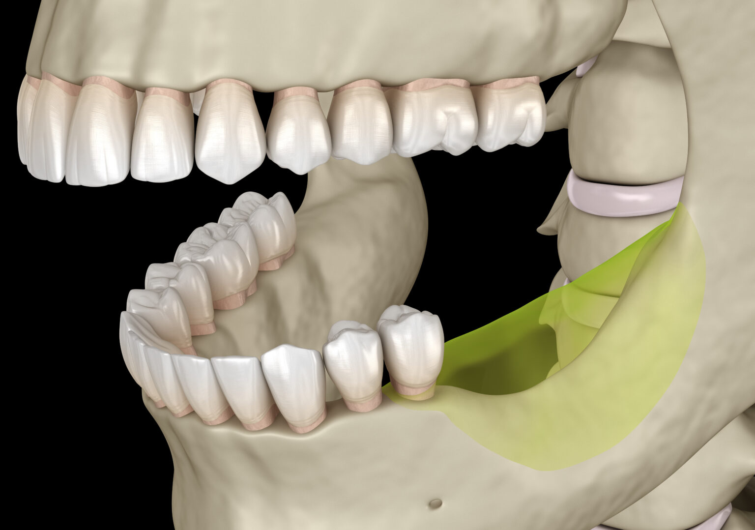 Better Balance With Orthognathic Surgery | Shirley, NY