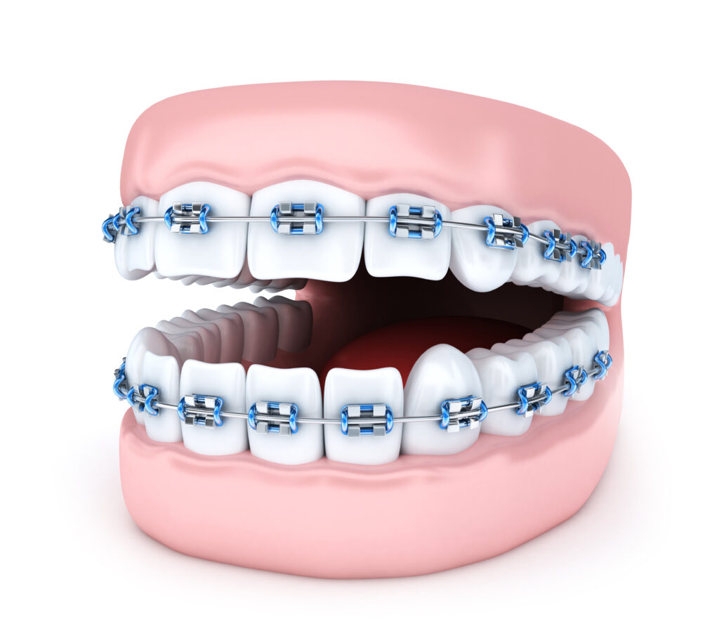 Why You Need To Treat Dental Misalignment | Shirley, NY